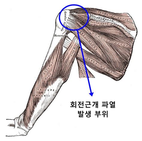 마디사랑병원 Community Blog