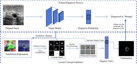 논문 리뷰 Lce A Framework For Explainability Of Dnns For Ultrasound