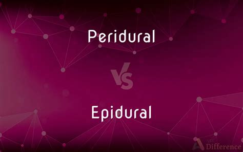 Peridural Vs Epidural Whats The Difference