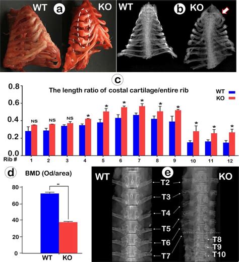 Dmp1 Ko Rabbits Displayed Significant Defects In Rib Cages And Download Scientific Diagram