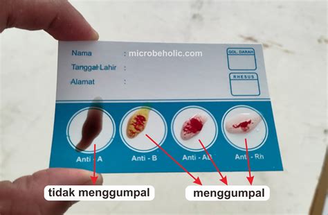 Prosedur Tes Golongan Darah Sistem Abo Dan Rhesus Microbeholic