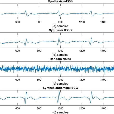 Synthesis Of Abdominal Ecg A Synthetic Mecg B Synthetic Fecg C Download Scientific Diagram