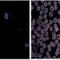 Example Of Segmentation Of A Cell A Original Image B Segmented Download Scientific Diagram
