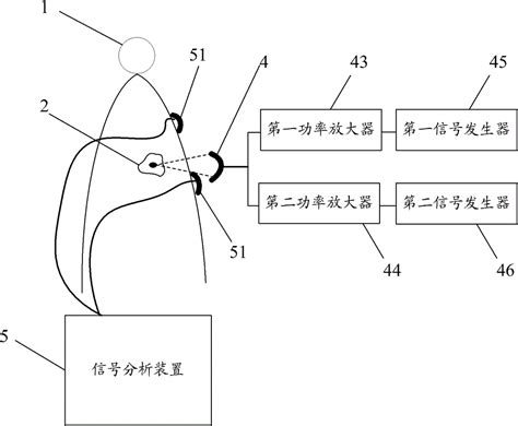 Double Frequency Focused Ultrasound System Eureka Patsnap