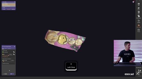 Exocad Level 1 Foundations The Mod Institute