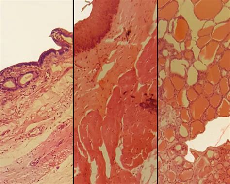 Prepared Microscope Slide Epithelium Composite Showing Stratified Squamous Simple Columnar