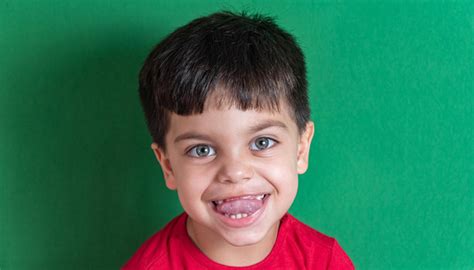 Permanent Tooth Eruption Fonixen