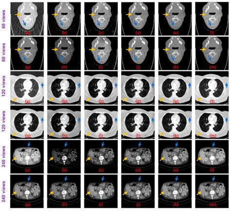 Degradation Aware Deep Learning Framework For Sparse View Ct Reconstruction Pmc