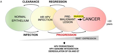 Human Oncogenic Viruses Characteristics And Prevention Strategies