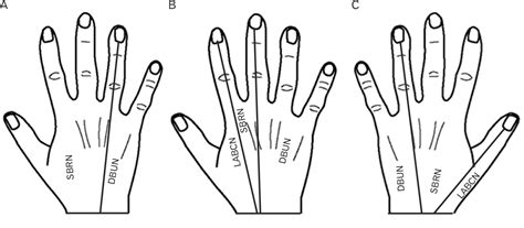 Dorsal Hand Innervation Sensation
