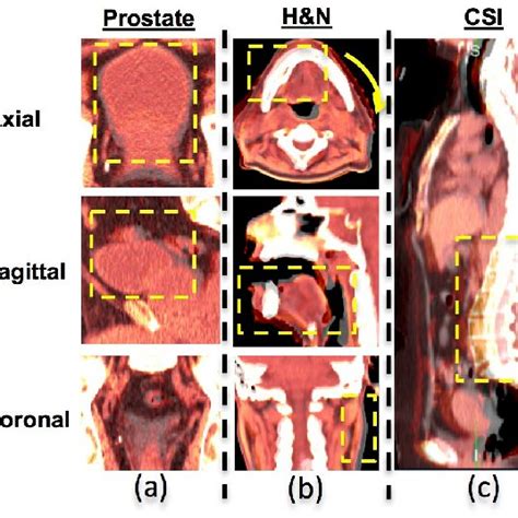The Composite Deformation Vector Field Dvf Field From Synthetic Handn Download Scientific