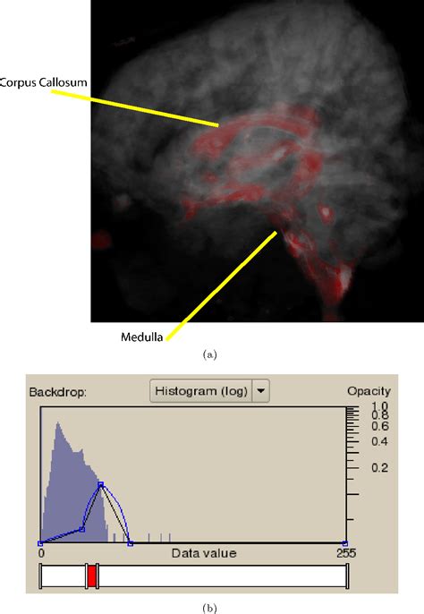 Figure 2 1 From Visualization And Exploration Of Time Varying And Diffusion Tensor Medical Image