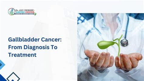 Early Signs Of Gallbladder Cancer Guidance Ppt