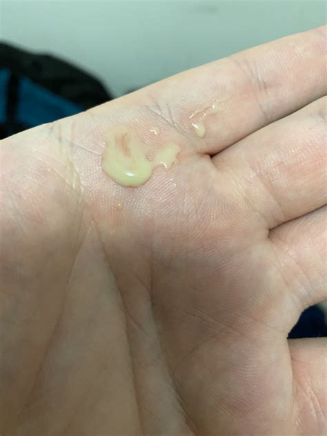 I Get Bumps Under My Armpit And They Always Shoot Out Like A Water