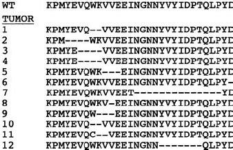 Exon KIT Mutations In GIST Samples The Wild Type WT Sequence Download Scientific