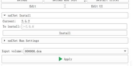 Dental Segmentator Error Support 3d Slicer Community