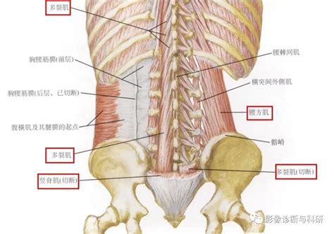 影像解剖 腰椎 椎旁肌群mr解剖 Medscicn