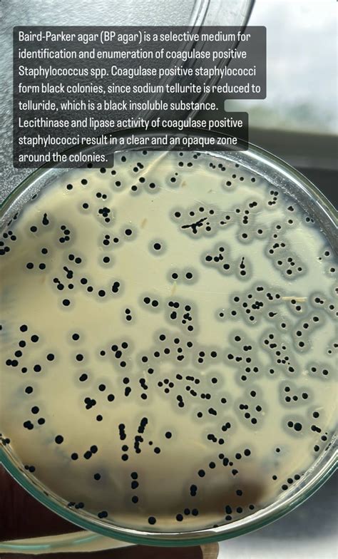 Nishali Anjula On Linkedin Typical Colonies In Bpa Staphylococcus Aureus