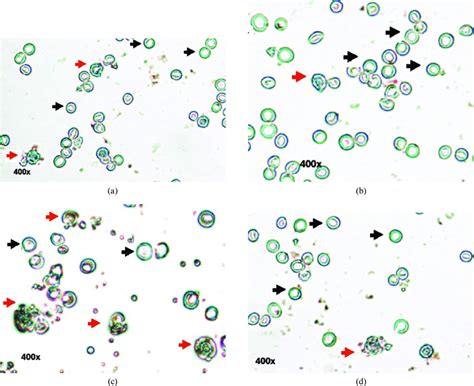 Dna Fragmentation Detected Using An Apoptosis Detection Tunel Kit Download Scientific Diagram