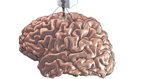 Neural Probe Protocols