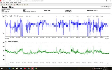 Can Someone Help Me Interpret My Oximeter Reading Charts MyApnea