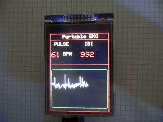 Arduino Portable Ekg Monitor Artofit