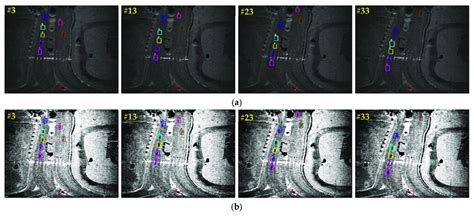 More Results Of The Histogram Equalization Shadow Enhancement Hese Download Scientific