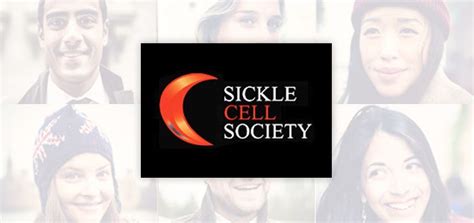 Nhs Sickle Cell And Thalassaemia Sct Screening Programme Sickle