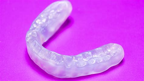 Tmj Splint Essos Dental Tmj Splint Essos Dental