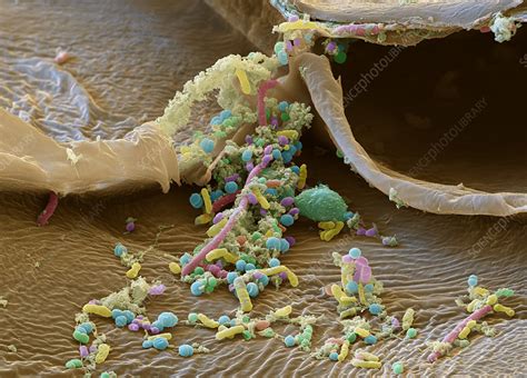 Sauerkraut Bacteria Sem Stock Image C049 1722 Science Photo Library