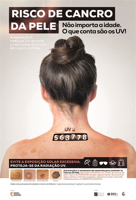 Risco De Cancro Da Pele Município De Penalva Do Castelo