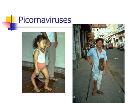 Ppt Lecture 32 Classification And Taxonomy Of Rna Viruses Powerpoint Presentation Id 305948