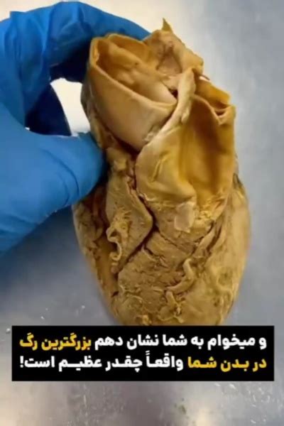شما به یک قلب واقعی انسان تستچی