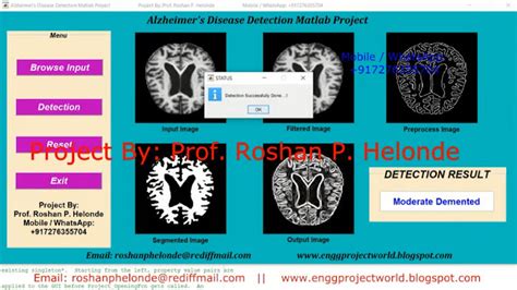 Alzheimers Detection Using Image Processing Alzheimers Disease
