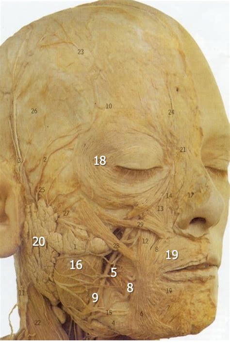 Anterolateral Face Diagram Quizlet