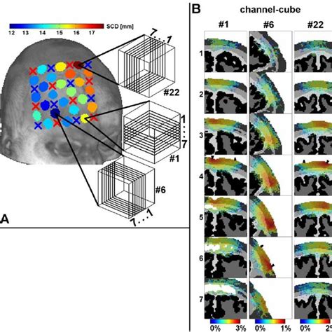 Thickness Of Scalp Skull And Csf Layer Download Table