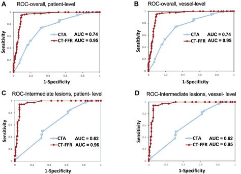 Diagnostic Accuracy Of Ct Ffr With A New Coarse To Fine Subpixel Algorithm In Detecting Lesion