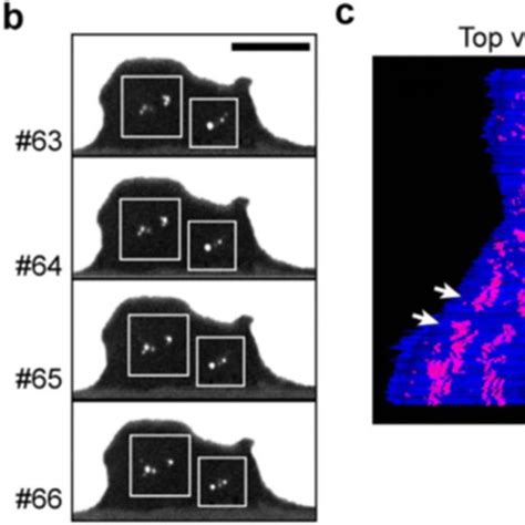 Three Dimensional Reconstruction Of Topo Iiα Localization In A Human
