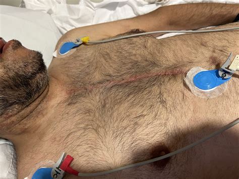 Neurology Station Paces Aid