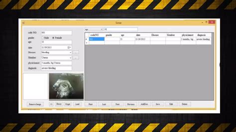 Basic Medical Imaging Processing And Analysis PPTX Photo Editing Software Computer
