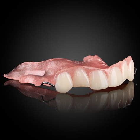 Acrylic Partial Denture Xdent Lab