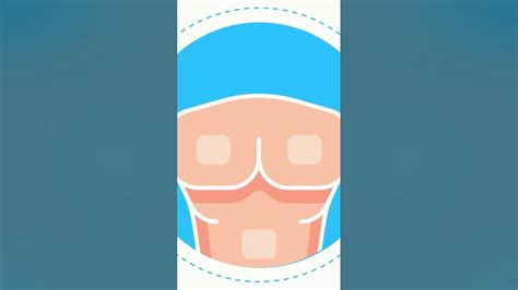 Sternal Dislocation Explained Causes Symptoms And Treatment Medical