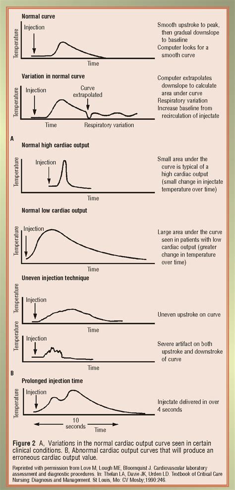 [pdf] Measuring Cardiac Output Intermittent Bolus Thermodilution Method Semantic Scholar