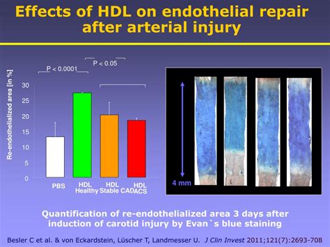 Ppt Hdl C Concentration Versus Hdl Particle Function What Exactly
