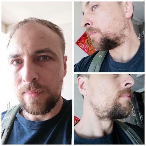 2 Months In Should I Trim Now Or Keep Going Looks Like My Trimming Options Are Kind Of Limited