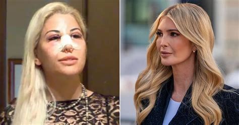 Woman Spends 60000 On Plastic Surgery To Look Like Very Elegant