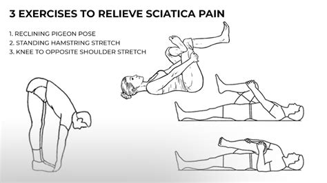 How To Cure Sciatica Permanently