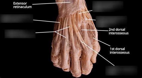 Hand Posterior View Diagram Quizlet