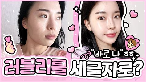 윤곽눈재수술귀족수술로 러블리 완성~ 성형로그 성형브이로그 Youtube