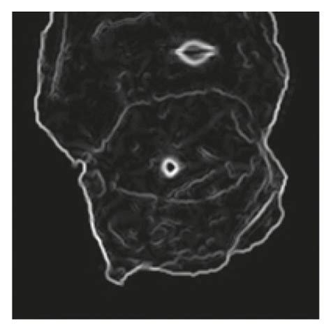 gradient images based on different methods a original image b